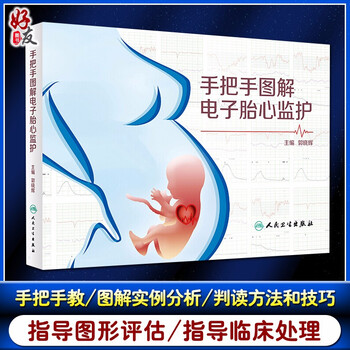 手把手图解电子胎心监护 胎心监护理论研究、监护方法的改进和和监护技术的发展 儿科学 郭晓辉 9787117282581人民卫生出版社