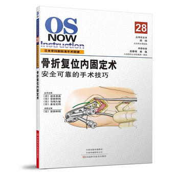 正版 骨折复位内固定术:安全可靠的手术技巧 (日)安田和则 主编 河南科学技术出版社