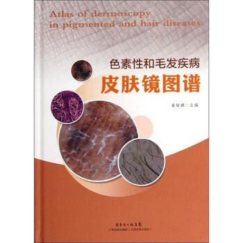 色素性和毛发疾病皮肤镜图谱 章星琪【正版书】
