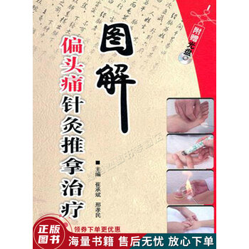 图解偏头痛针灸推拿治疗