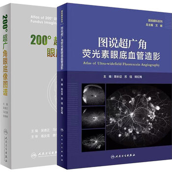 正版 图说超广角荧光素眼底血管造影+200°超广角眼底像图谱 人民卫生出版社
