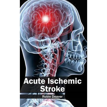 Acute Ischemic Stroke