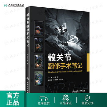 髋关节翻修手术笔记 外科学人民卫生出版社