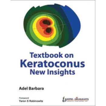 Textbook on Keratoconus: New Insights