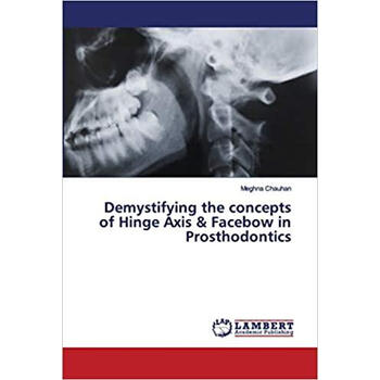 Demystifying the concepts of Hinge Axis & Facebo