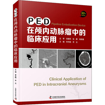 PED在颅内动脉瘤中的临床应用