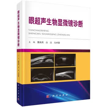 眼超声生物显微镜诊断/魏海英,白洁,冯卓蕾