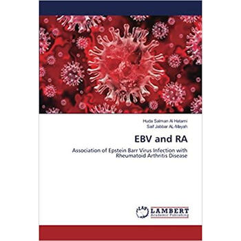 EBV and RA