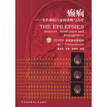 癫痫发作和综合征的诊断与治疗