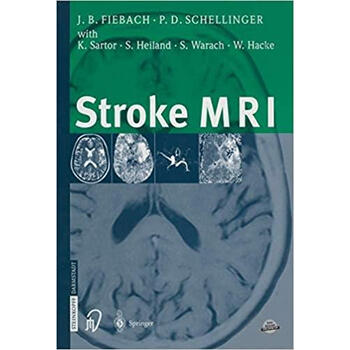 Stroke MRI