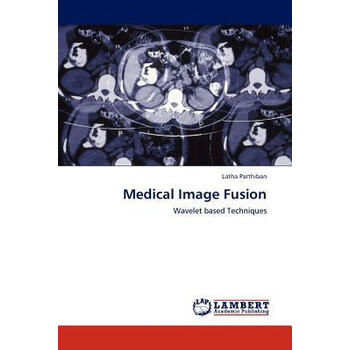 Medical Image Fusion