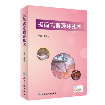 极简式宫颈环扎术（配增值） 夏恩兰
