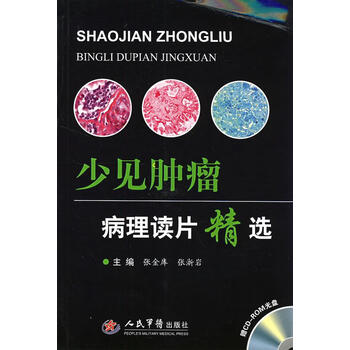 少见肿瘤病理读片精选