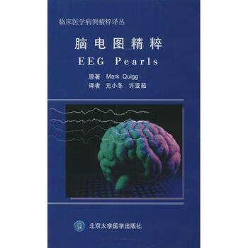 脑电图精粹 [美] 吉格（Quigg M.） 著,元小冬,许亚茹 译