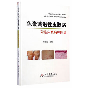 色素减退性皮肤病：附临床及病理图谱