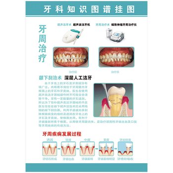 牙科宣传画口腔科海报牙齿结构功能知识解剖图谱挂图墙贴画WSA54 WSA54-07 牙周治疗 40x60cm  PP覆膜贴纸