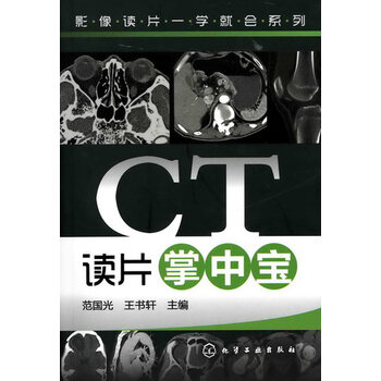 影像读片一学就会系列--CT读片掌中宝【正版图书】