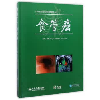 食管癌【正版图书】