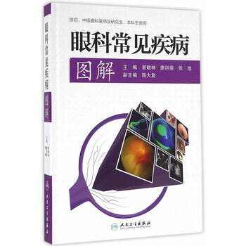 眼科常见疾图解【正版图书】