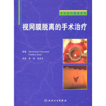 视网膜脱离的手术治疗【正版图书】