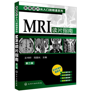 影像读片从入门到精通系列：CT读片指南（第2版） CT读片指南(第2版)