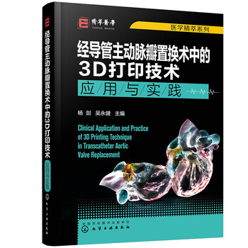 医学精萃系列--经导管主动脉瓣置换术中的3D打印技术——应用与实践