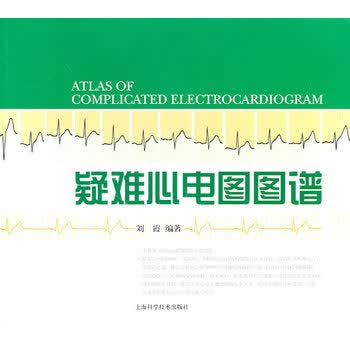 疑难心电图图谱【正版图书】