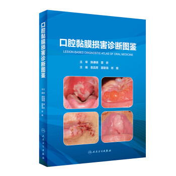 口腔黏膜损害诊断图鉴 袁昌青,聂敏海,邓婧