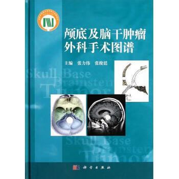 [按需印刷]颅底及脑干肿瘤外科手术图谱