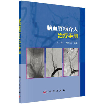 [按需印刷]脑血管病介入治疗手册