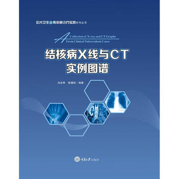 结核病X线与CT实例图谱