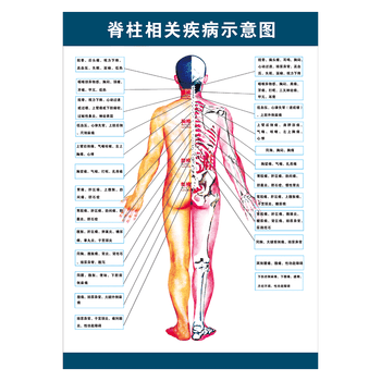 中医宣传画挂图中药配伍禁忌歌十八反十九畏歌脊柱图墙贴画WSA WSA37 脊柱相关疾病示意图 70*50厘米 覆膜防水PP贴纸