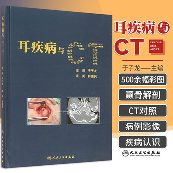 z包邮正版 耳疾病与CT(精装、图文版)于子龙质变 人民卫生出版社