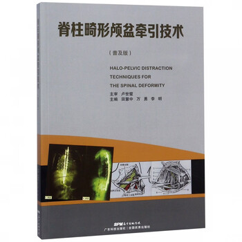 脊柱畸形颅盆牵引技术(普及版)