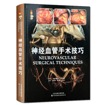 神经血管手术技巧 血管外科手术 书籍 天津科技翻译出版有限公司
