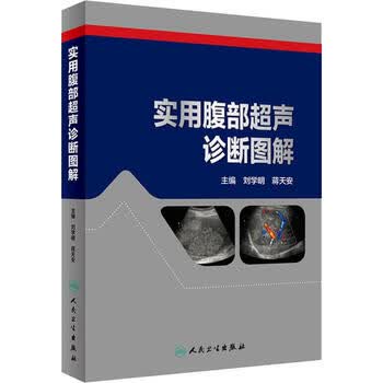 实用腹部超声诊断图解