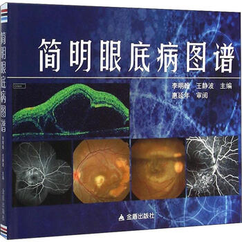 简明眼底病图谱