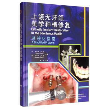 上颌无牙颌美学种植修复系统化指南