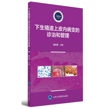 下生殖道上皮内病变的诊治和管理