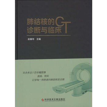 肺结核的CT诊断与临床