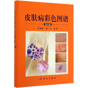 皮肤病彩色图谱(第4版)
