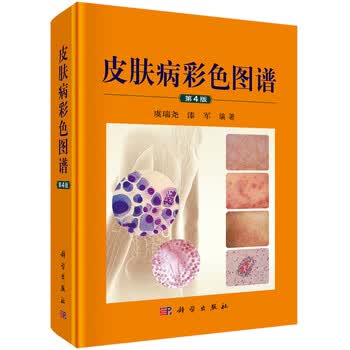 [正版图书]皮肤病彩色图谱