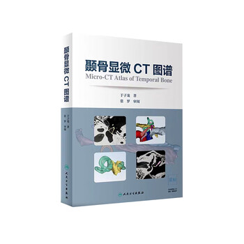   颞骨显微CT图谱（配增值） 于子龙 著 耳鼻咽喉科学 
