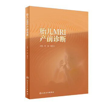 胎儿MRI产前诊断