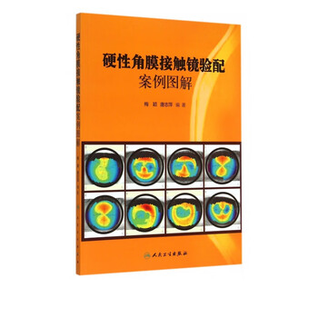 硬性角膜接触镜验配案例图解