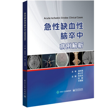 急性缺血性脑卒中病例解析