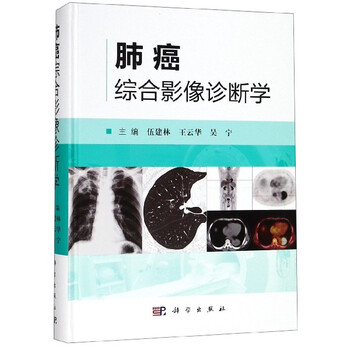 肺癌综合影像诊断学(精)