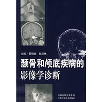 颞骨和颅底疾病的影像学诊断【正版图书】