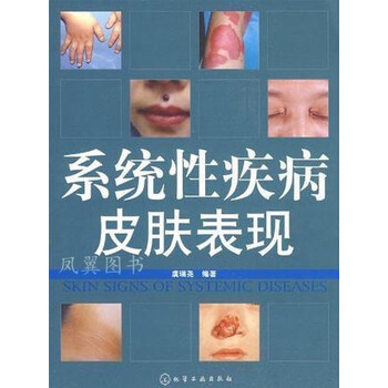 系统性疾病皮肤表现 虞瑞尧著 化学工业出版社