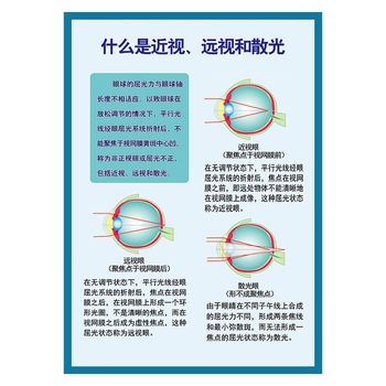 近视宣传画海报挂图保护视力远视表远视图眼睛视力训练图墙贴画覆膜贴纸SCH WST25 近视远视 70*50厘米 PP覆膜贴纸
